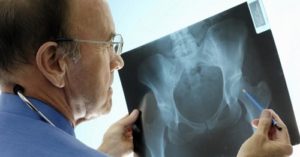 ÁCIDO ALENDRÓNICO » Usos, Efectos Y Contraindicaciones